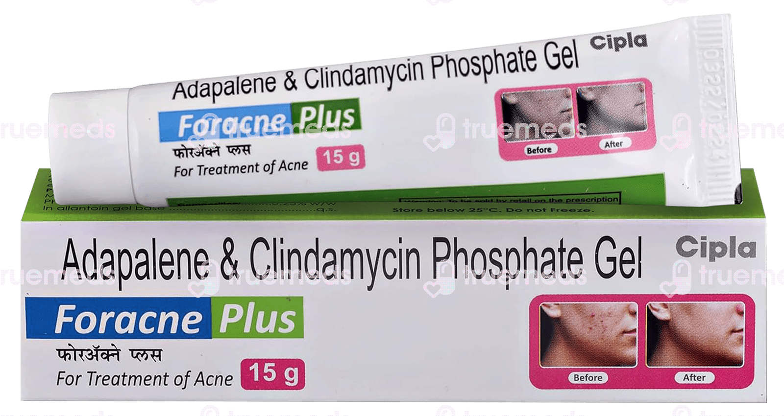 Foracne Plus 0.1/1% Gel 15 GM | Order Foracne Plus 0.1/1 % Gel 15 GM ...