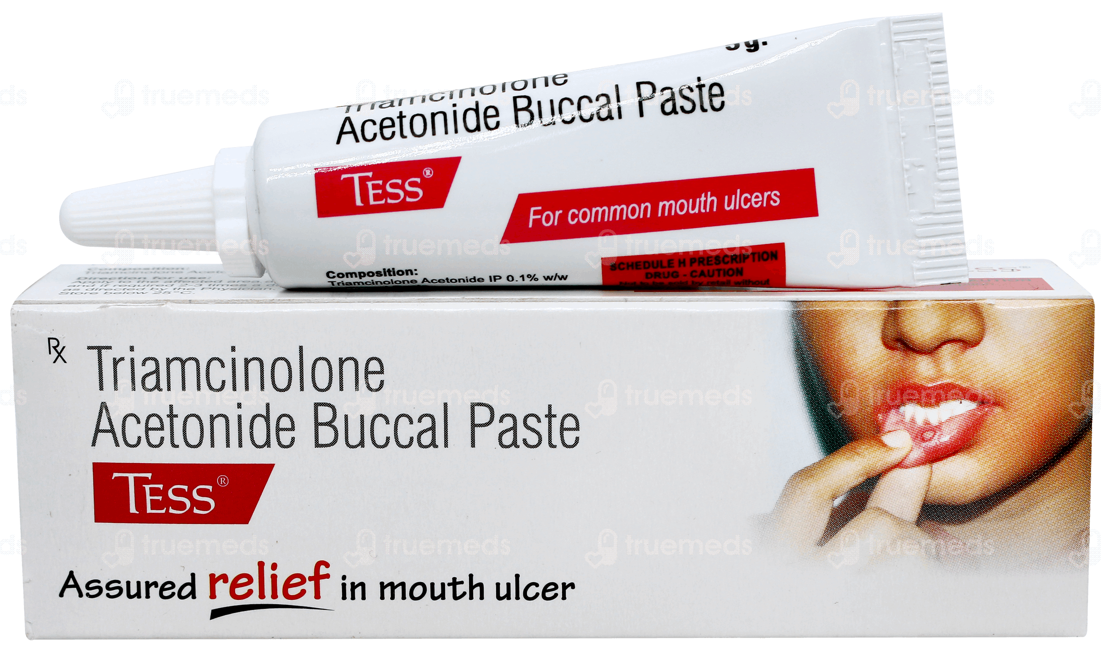 Tess 0.1 % Paste 5 GM | Order TESS 0.1 % PASTE 5 GM Online at Truemeds